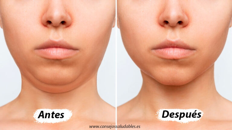 Mewing: ¿Realmente funciona esta técnica viral para definir el rostro?